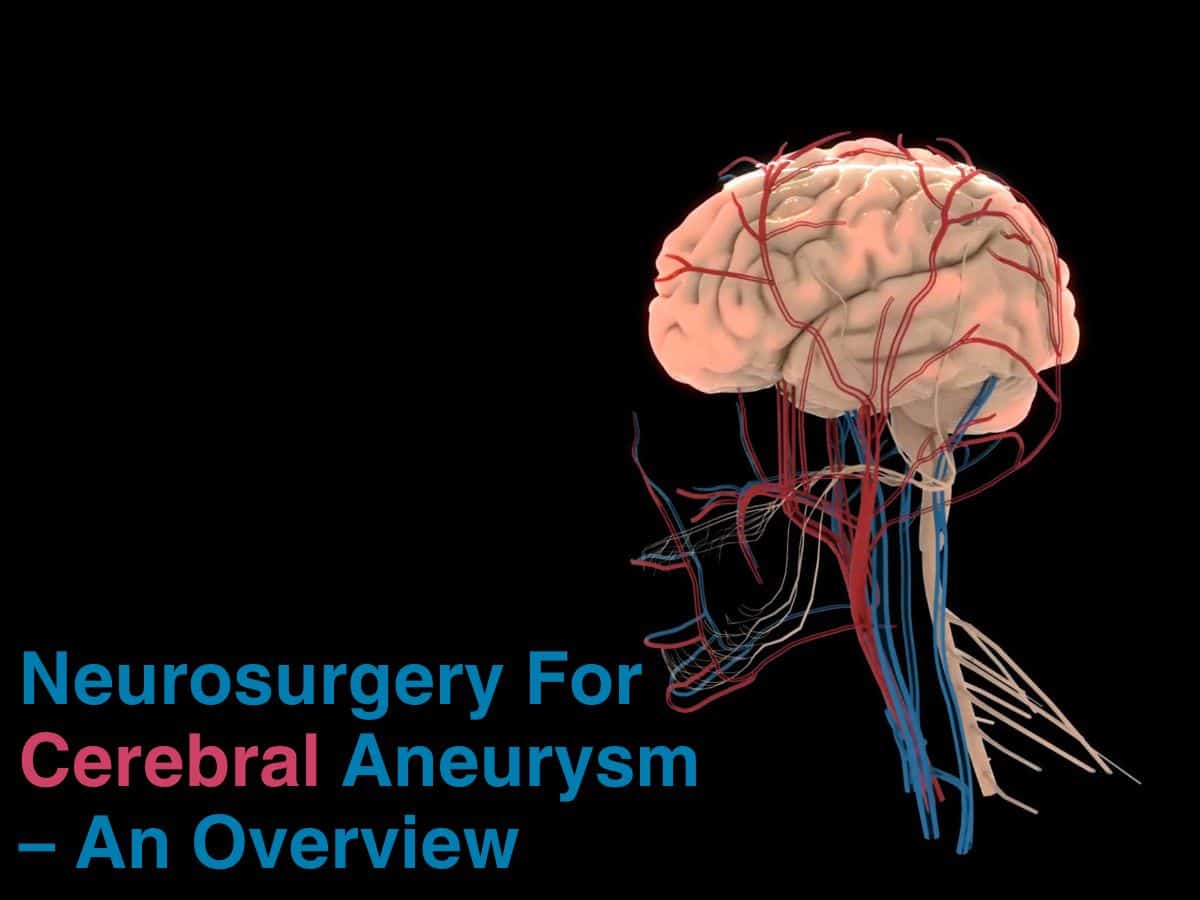 Neurosurgery For Cerebral Aneurysm An Overview Multispeciality Hospital