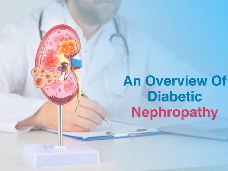 An Overview Of Diabetic Nephropathy - Multispeciality Hospital