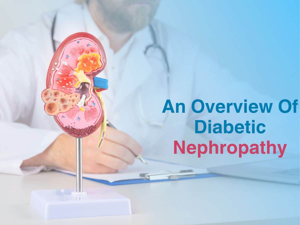 An Overview Of Diabetic Nephropathy - Multispeciality Hospital