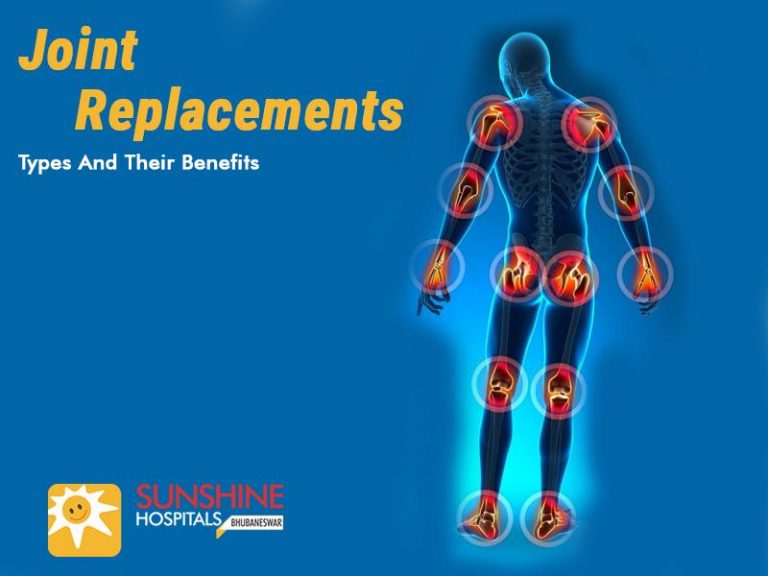 Joint Replacements – Types and Their Benefits - Multispeciality Hospital
