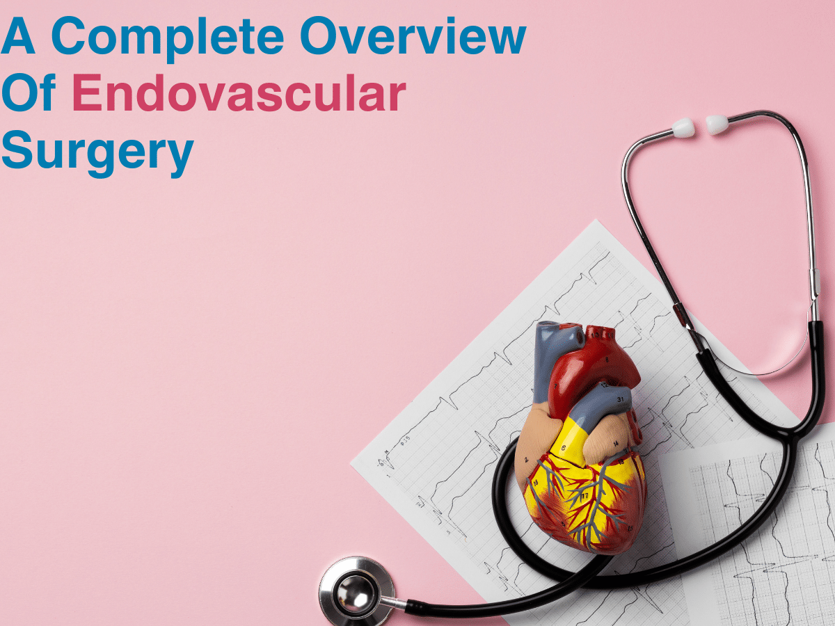 A Complete Overview Of Endovascular surgery - Multispeciality Hospital