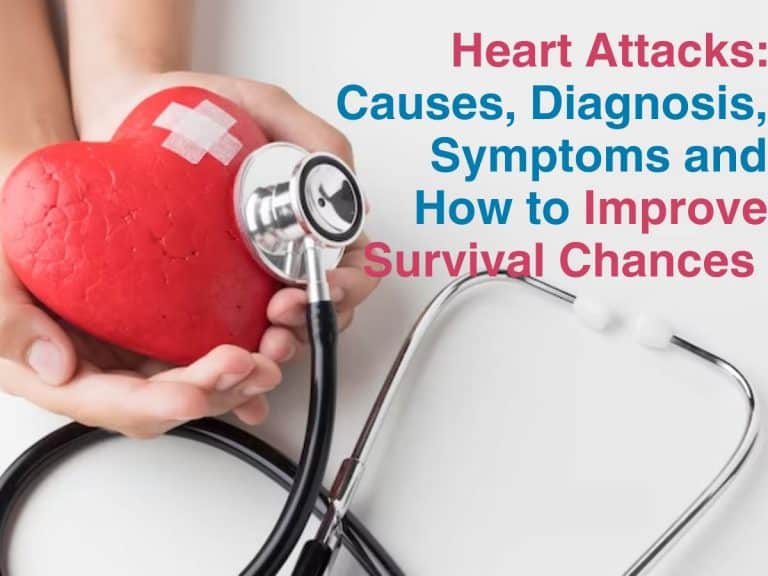Heart Attacks: Causes, Diagnosis, Symptoms and How to Improve Survival ...
