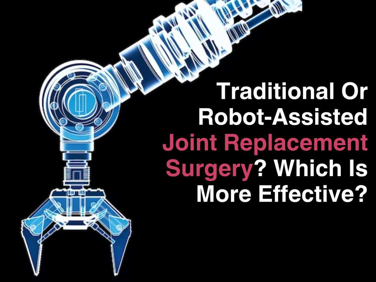 Traditional or Robot-assisted joint replacement surgery? Which is more ...