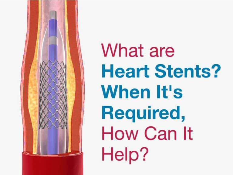 What are Heart Stents? When It’s Required, What Errors to Avoid, How ...