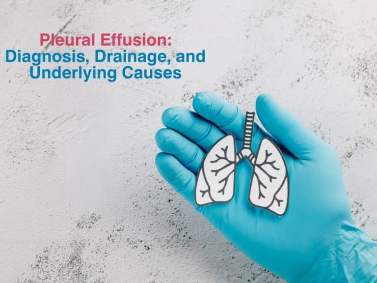 Pleural Effusion: Diagnosis, Drainage, and Underlying Causes