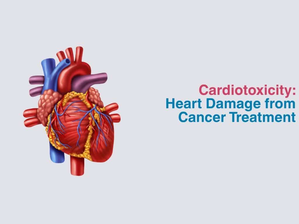 Cardiotoxicity: Heart Damage from Cancer Treatment