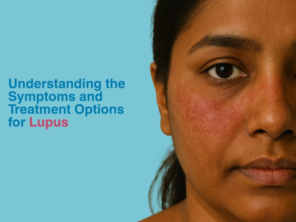 Understanding the Symptoms and Treatment Options for Lupus