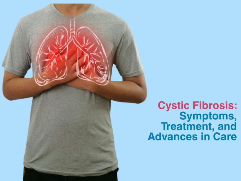 Cystic Fibrosis: Symptoms, Treatment, and Advances in Care
