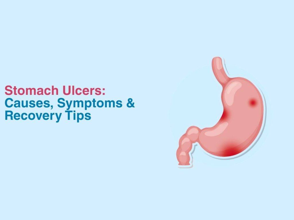 Stomach Ulcers: Causes, Symptoms & Recovery Tips - Multispeciality Hospital