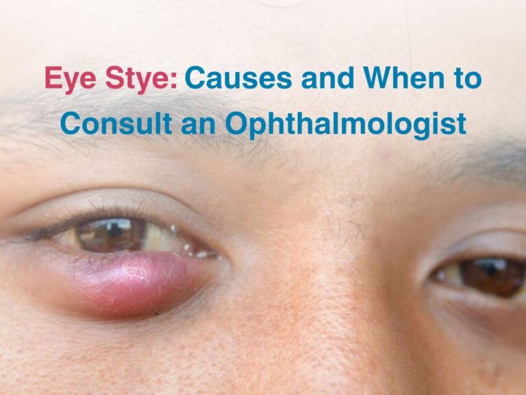 Eye Stye: Causes and When to Consult an Ophthalmologist