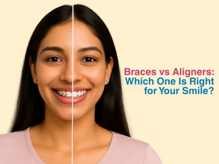Braces vs Aligners: Which One Is Right for Your Smile?