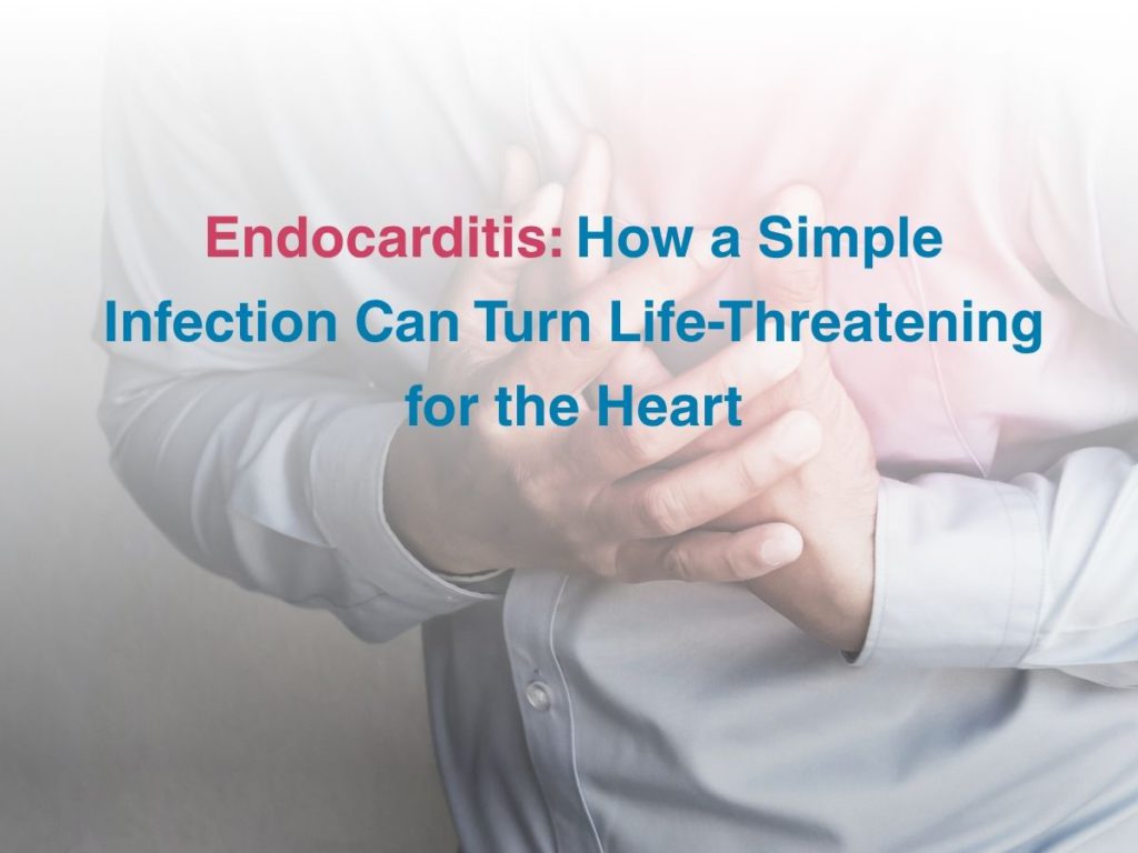 Endocarditis: How a Simple Infection Can Turn Life-Threatening for the ...