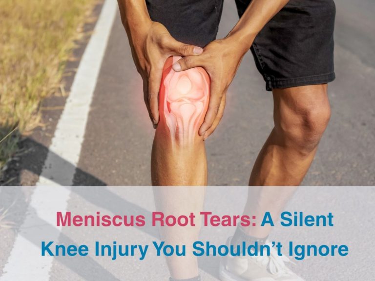 Meniscus Root Tears: A Silent Knee Injury You Shouldn’t Ignore