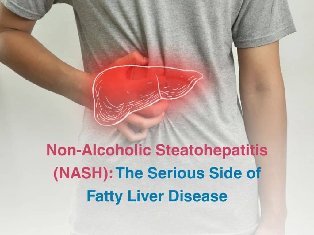 Non-Alcoholic Steatohepatitis (NASH): The Serious Side of Fatty Liver ...