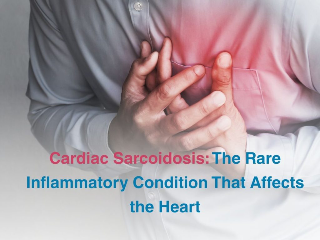 Cardiac Sarcoidosis: The Rare Inflammatory Condition That Affects the Heart